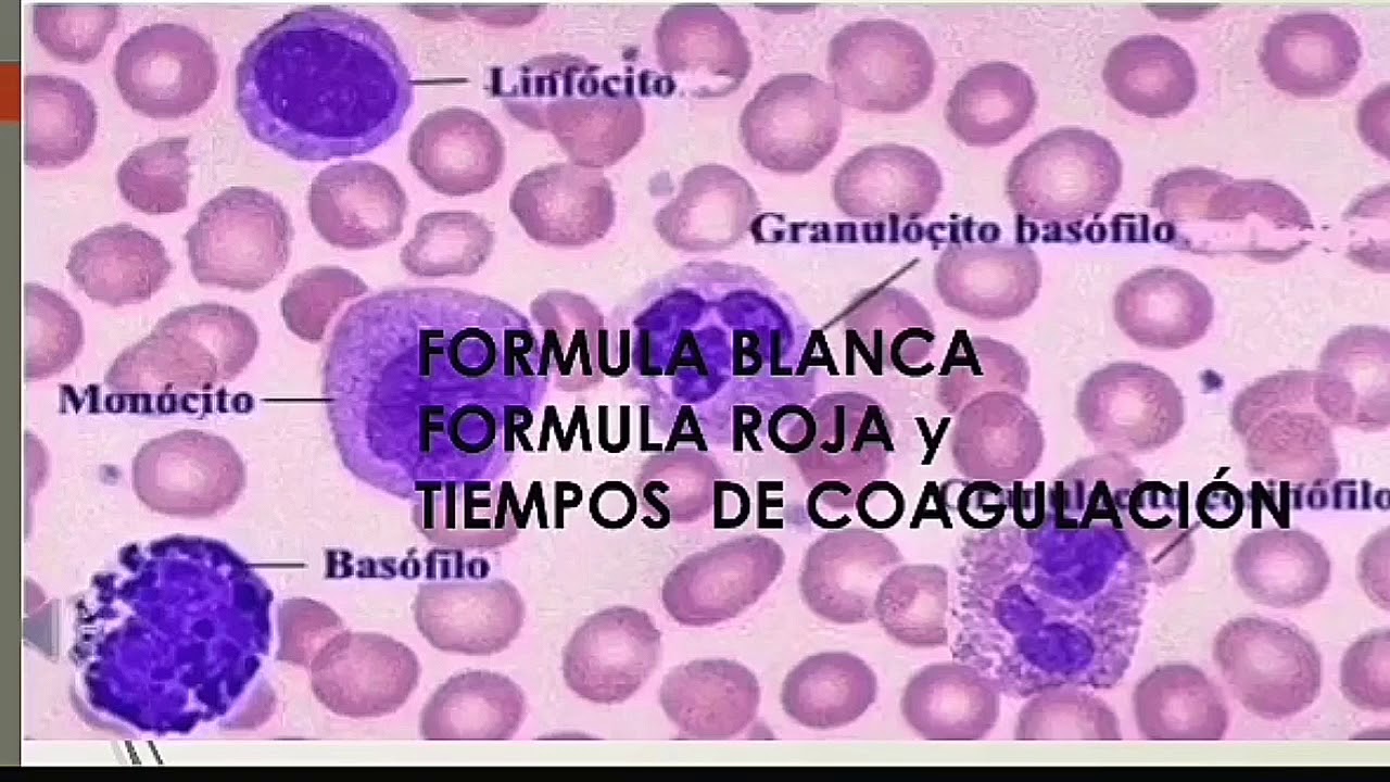 Fórmula blanca, roja y tiempos de coagulación - YouTube
