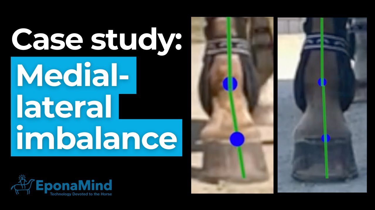 Case Study: Achieving Medial-Lateral Balance with Trim and Shoe ...