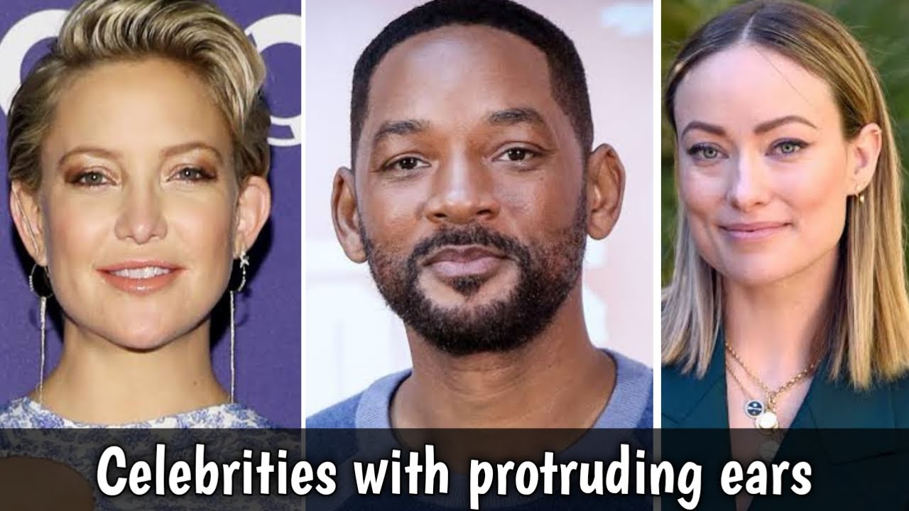 Celebrities With Big Ears