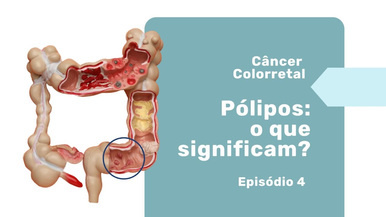 Neurologia - Instituto Medicina em Foco