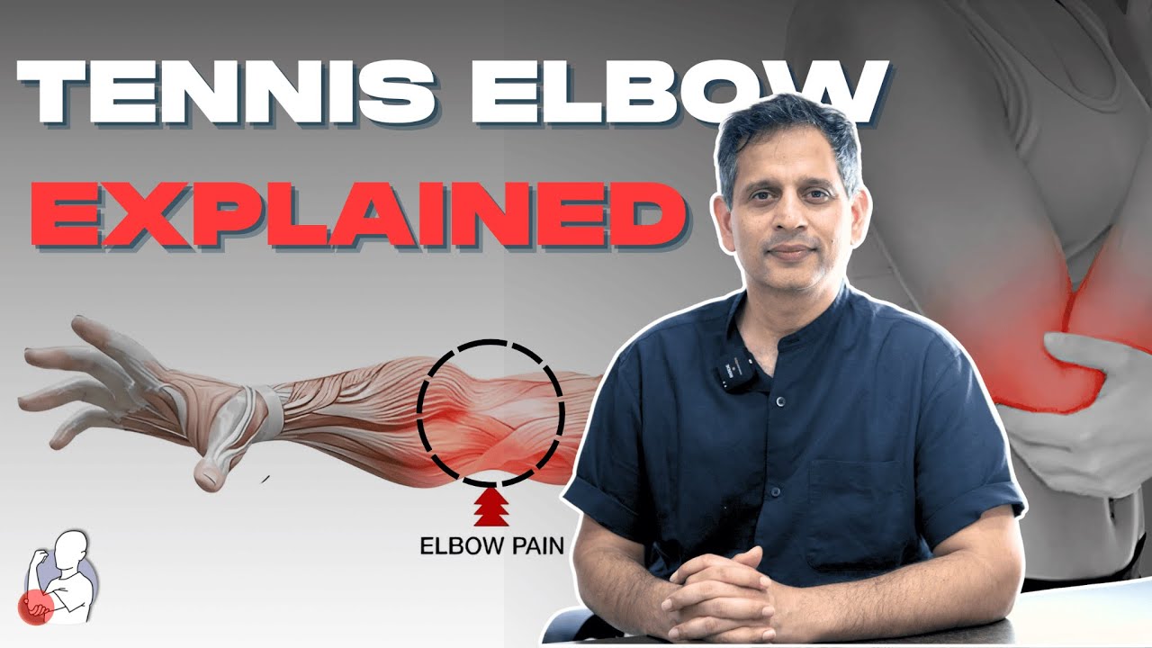 Tennis Elbow Explained | Causes, Symptoms & Simple Solutions for Pain ...