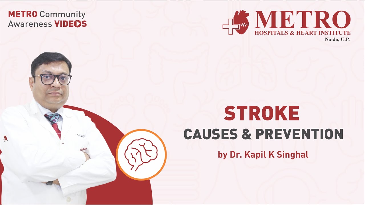 Stroke Causes and Prevention by Dr. Kapil K Singhal Metro Hospital Noida - YouTube