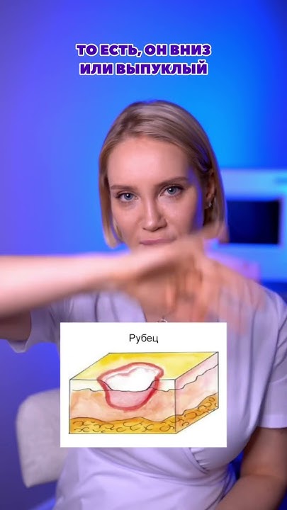 Как убрать рубцы и шрамы Youtube