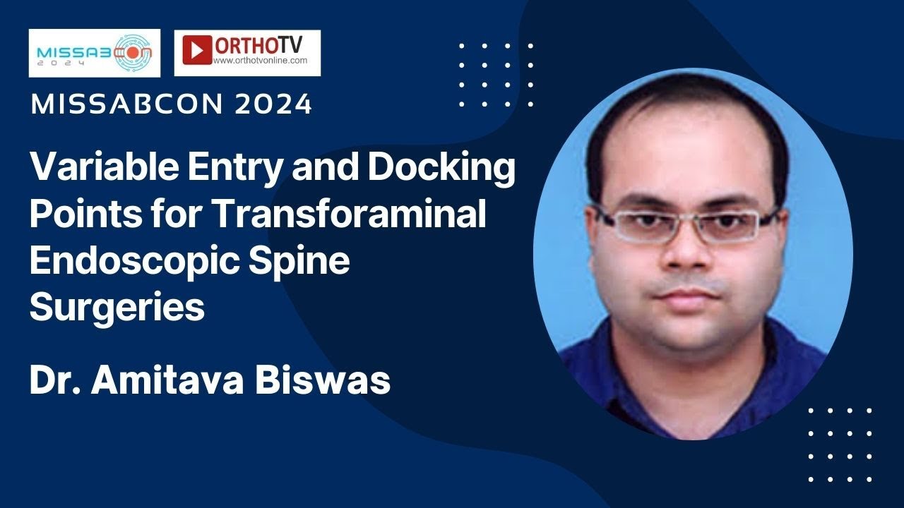 **MISSABCON 2024: Variable Entry & Docking in Transforaminal Endoscopy – Dr. Amitava Biswas ...