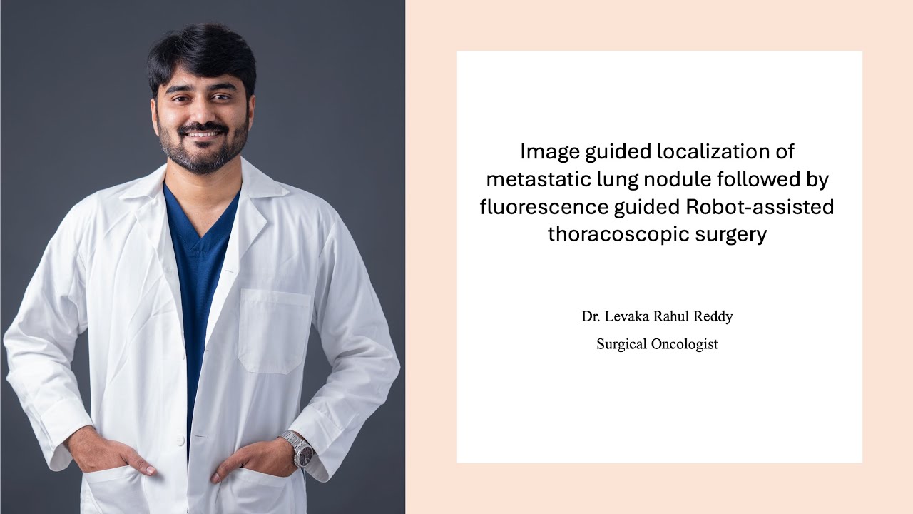 Robotic Metastasectomy following Image guided localisation using Indo ...