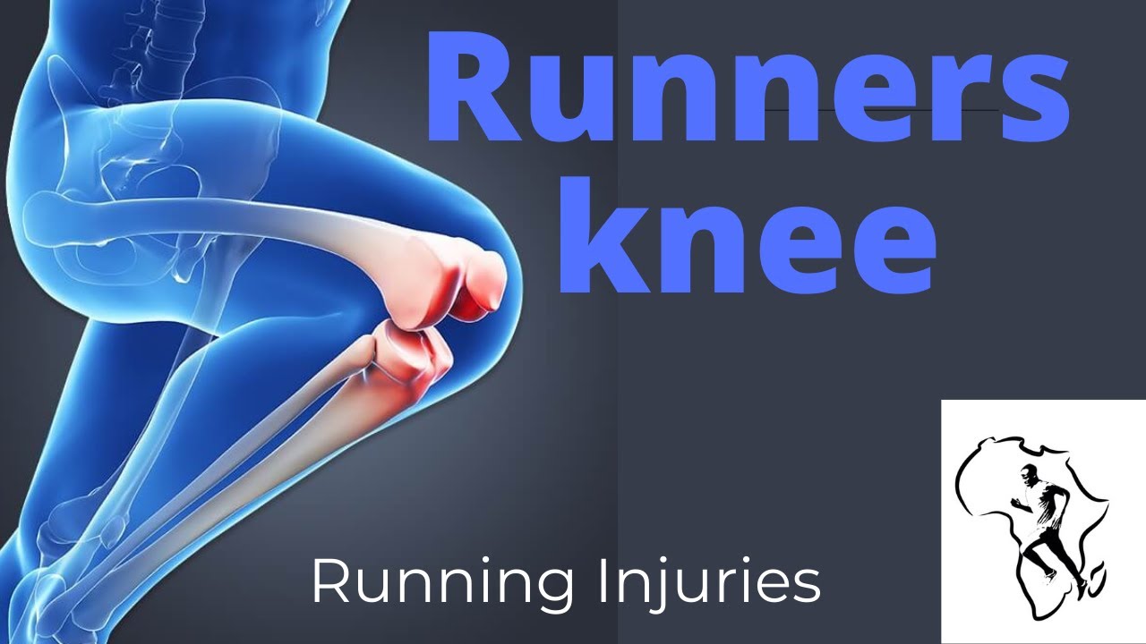 Runner's knee injury. Running injuries series - YouTube