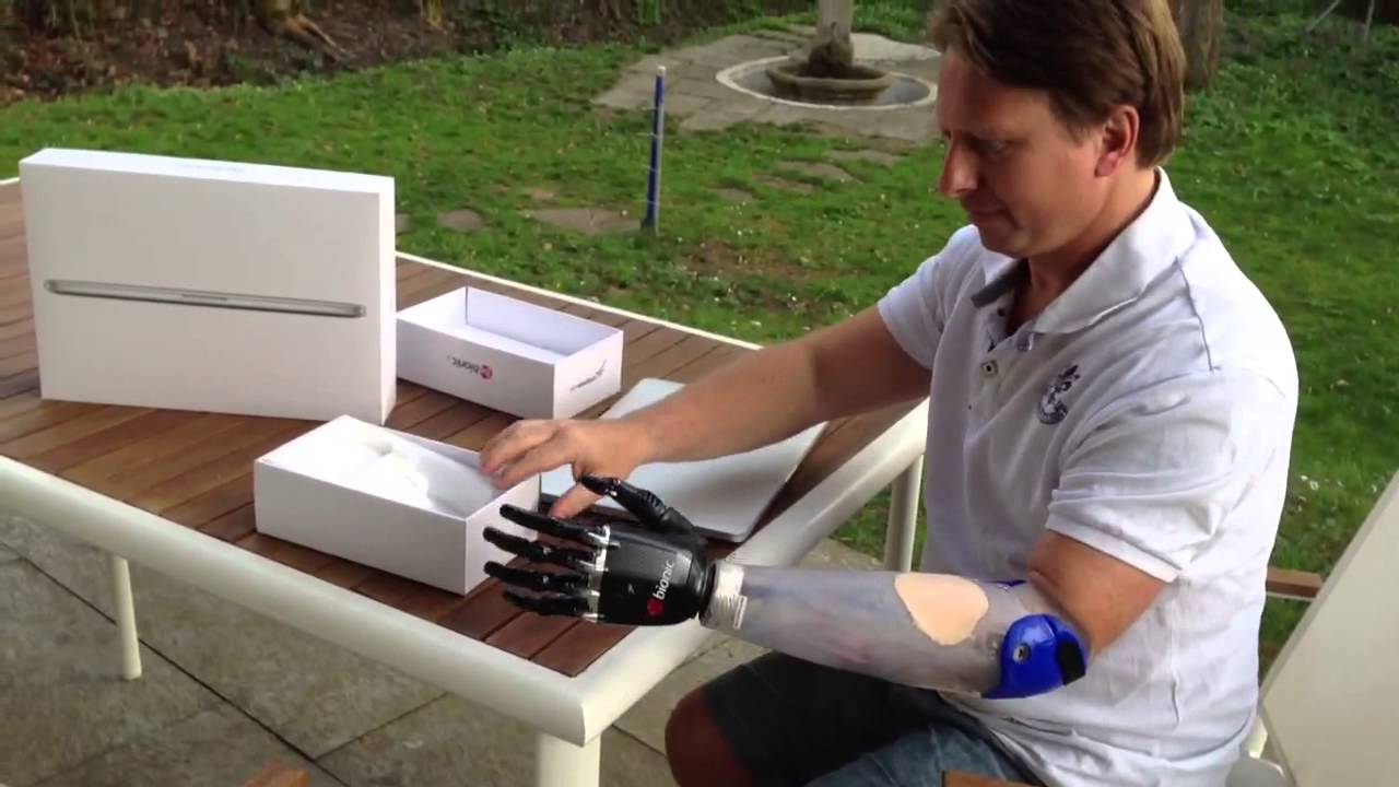 Bebionic 3 Arm Tag 6 Jo Stark - YouTube
