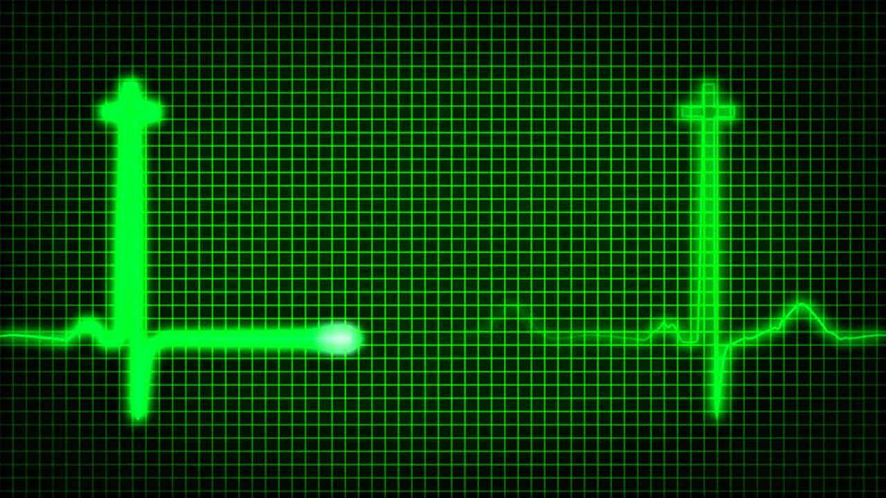 Cross EKG - YouTube