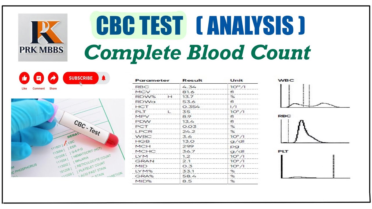 CBC Blood Test | Complete Blood Count Test | Hemogram Report | Analysis ...