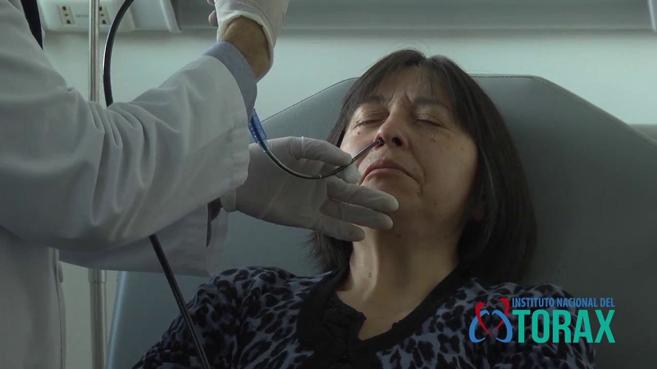 Nasofibroscopía: Nueva tecnología para exámenes médicos - YouTube