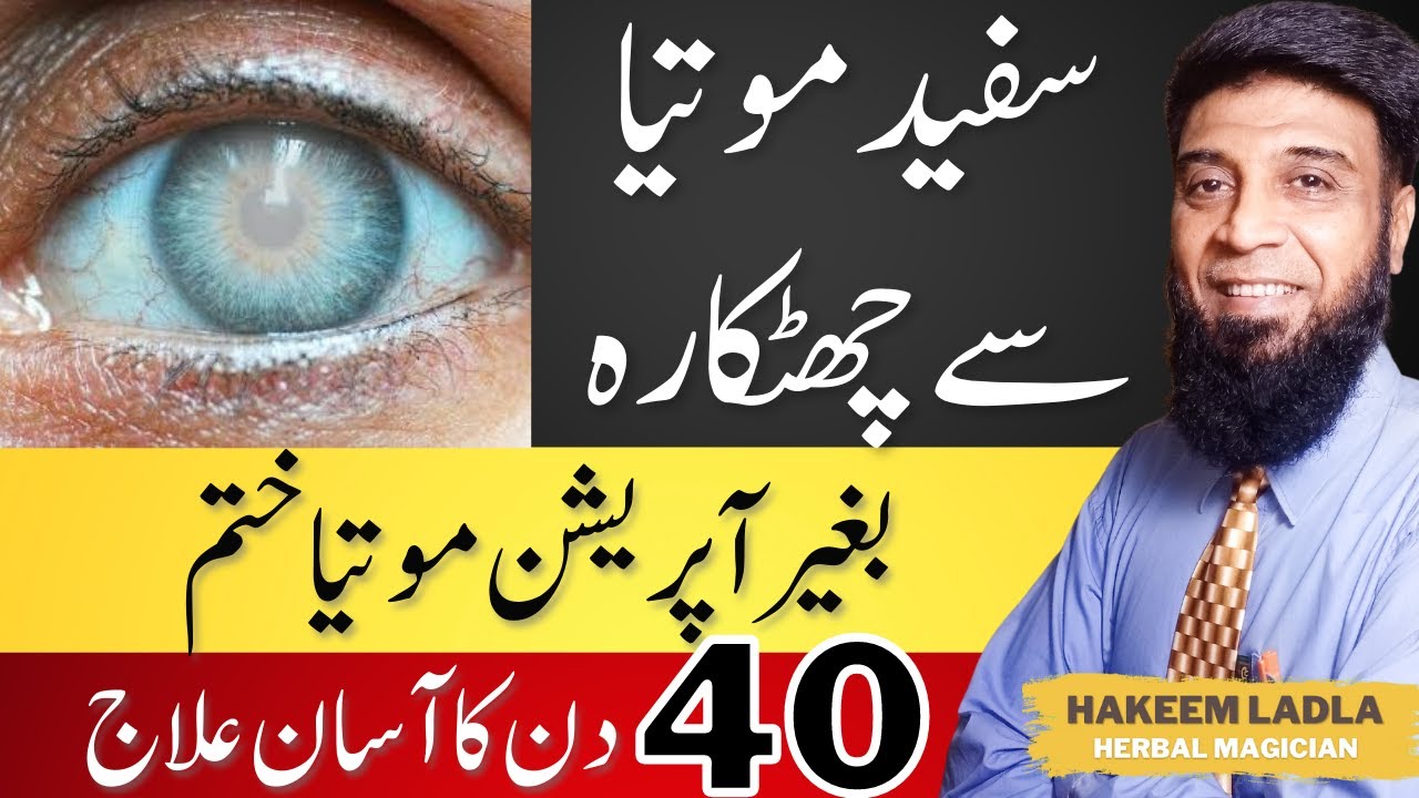 Safed Motia ka Bagair Operation ilaj | Safed Motia Ka ilaj | Cataract ...
