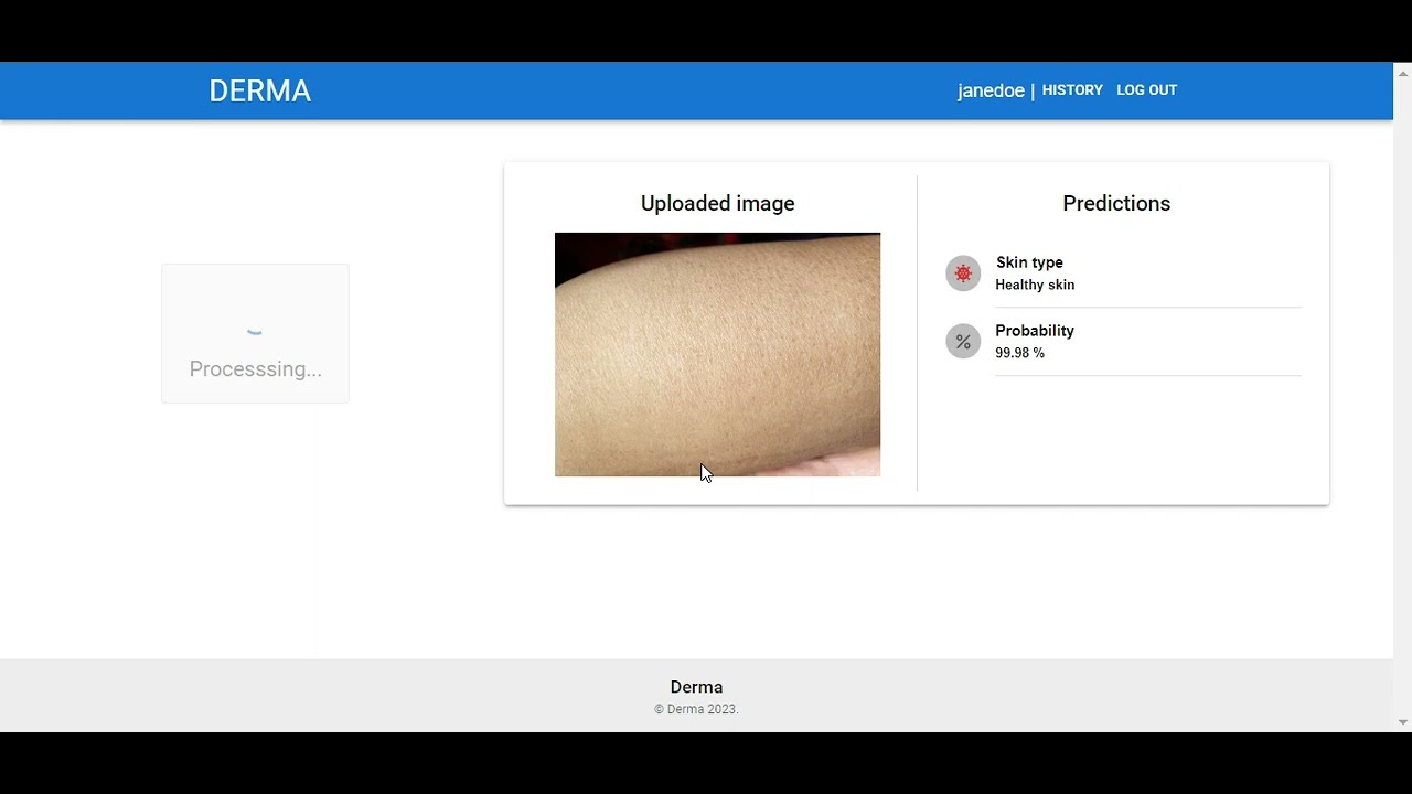 👩‍⚕️ Derma: Your AI Skin Health Assistant! 🌟 - YouTube