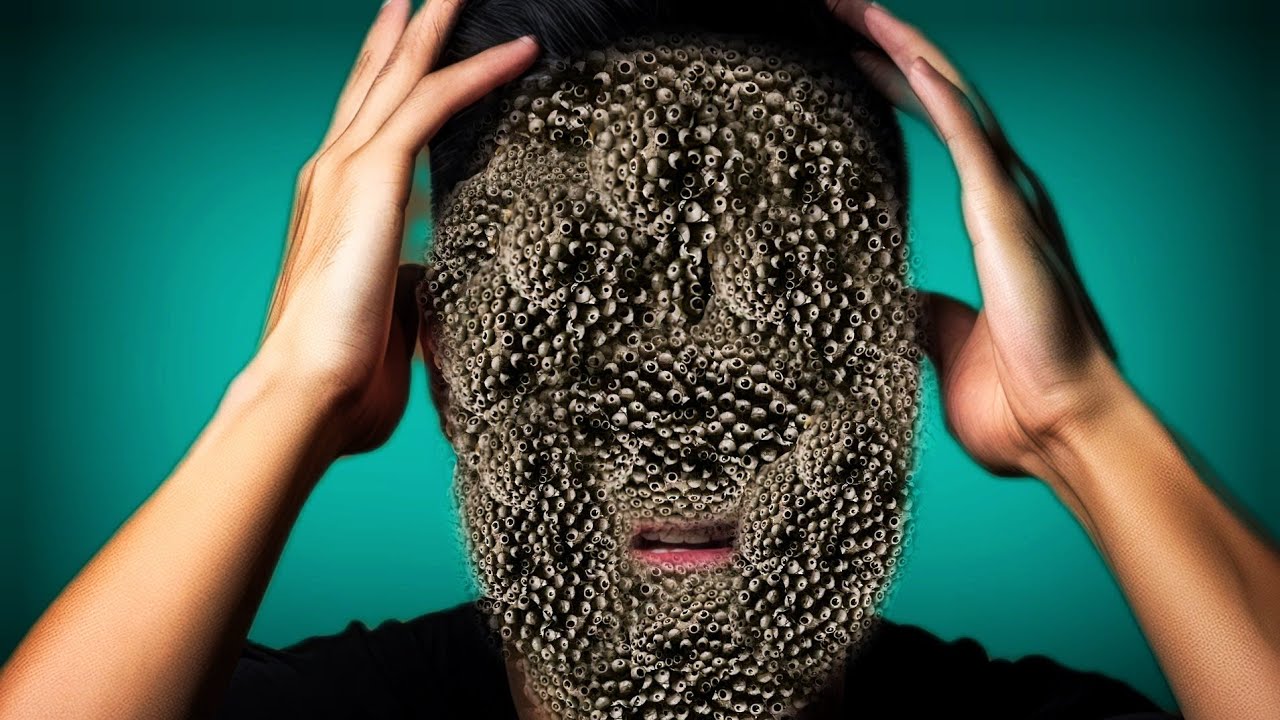 😭ASMR urgent face treatment | ASMR removal maggot & insect trypophobia ...