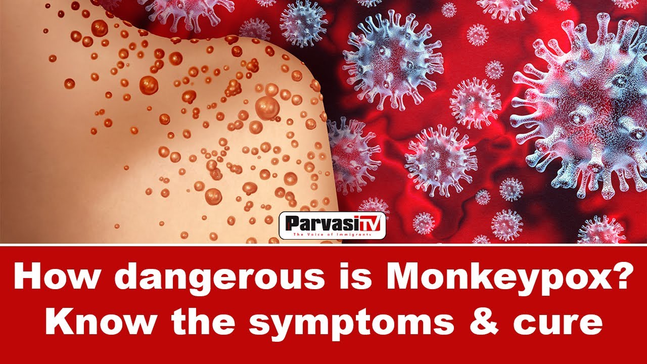 How dangerous is Monkeypox?- Know the symptoms & cure | Parvasi TV ...