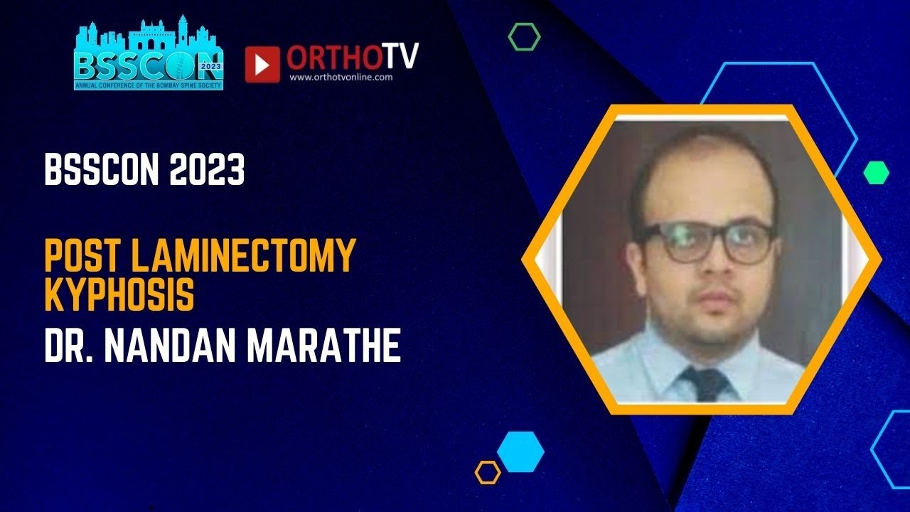 BSSCON 2023 : Post laminectomy kyphosis - Dr. Nandan Marathe - YouTube