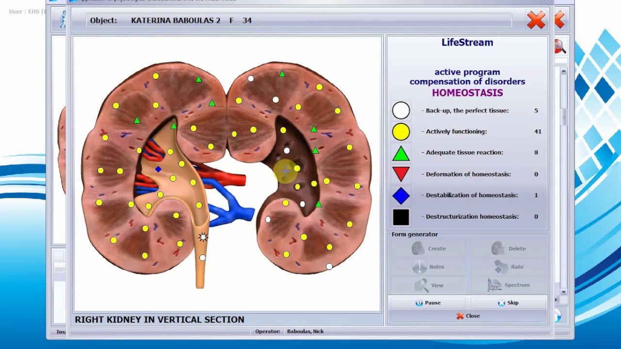 SENSITIV IMAGO BIORESONANCE SCAN PART 3: What a physical scan of ORGANS ...
