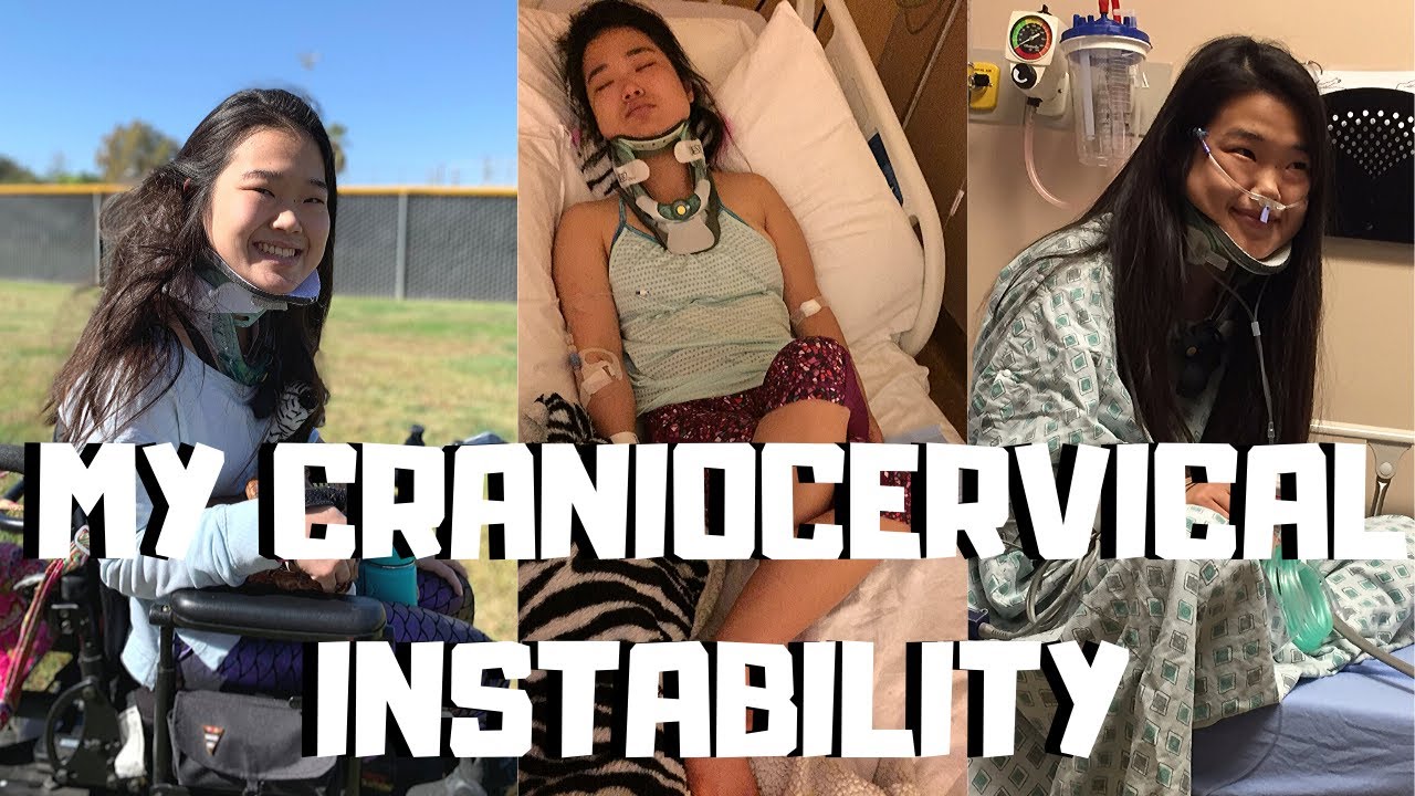 MY CRANIOCERVICAL INSTABILITY SYMPTOMS - YouTube