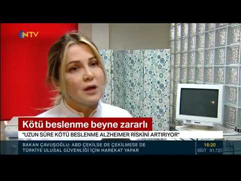 İşlenmiş Gıdalar Beyne Zarar Veriyor-İÜC Cerrahpaşa Tıp Fakültesi Öğretim Üyesi Derya Uludüz