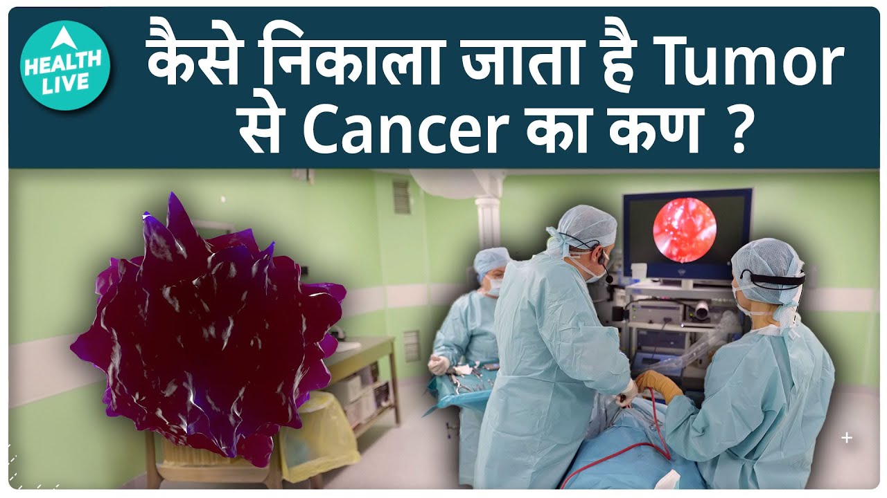 What is Biopsy? | How is it Helpful for Cancer | Health Live - YouTube