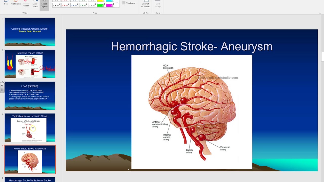 Pathophysiology of Cerebral Vascular Accident (Stroke) - YouTube