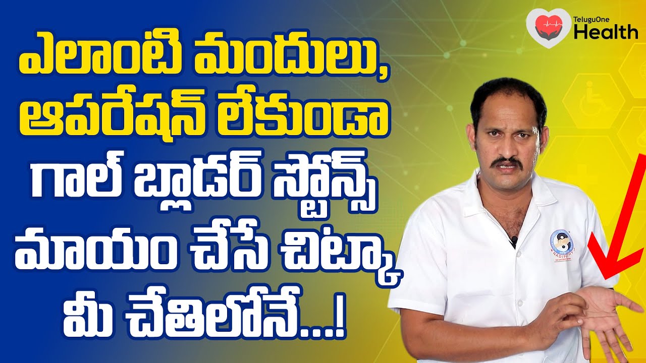 Gallbladder Stones | ఆపరేషన్ లేకుండా గాల్ బ్లాడర్ స్టోన్స్.. Dr. P ...