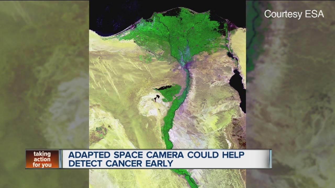 Space satellite camera could help detect skin diseases early - YouTube