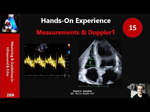 Hands-On Experience 15: Measurements & Doppler 1 - YouTube