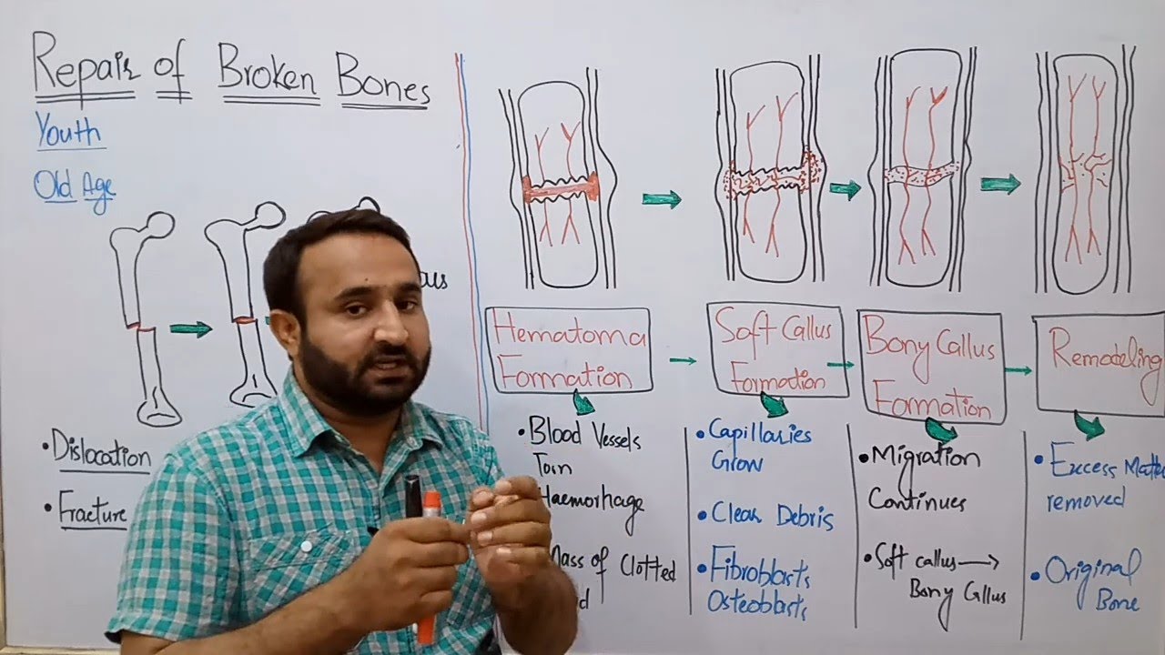Ch 16 Lec 13 Repair of Broken Bones, Class 12 Biology - YouTube