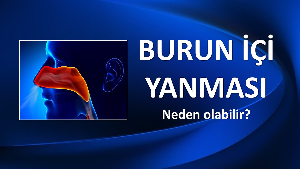 BURUN İÇİ YANMASI - YouTube
