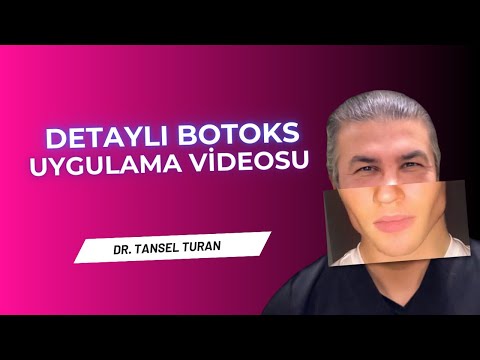 Detaylı Botoks Uygulama Videosu