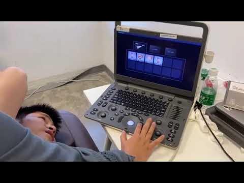 Sonoscape E2 Portable Ultrasound Machine with Real-Time Panoramic ...