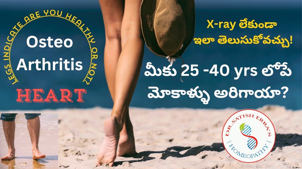 Legs tell Ur heart is healthy-not? Osteo Arthritis? ఆర్థరైటిస్!Heart ...