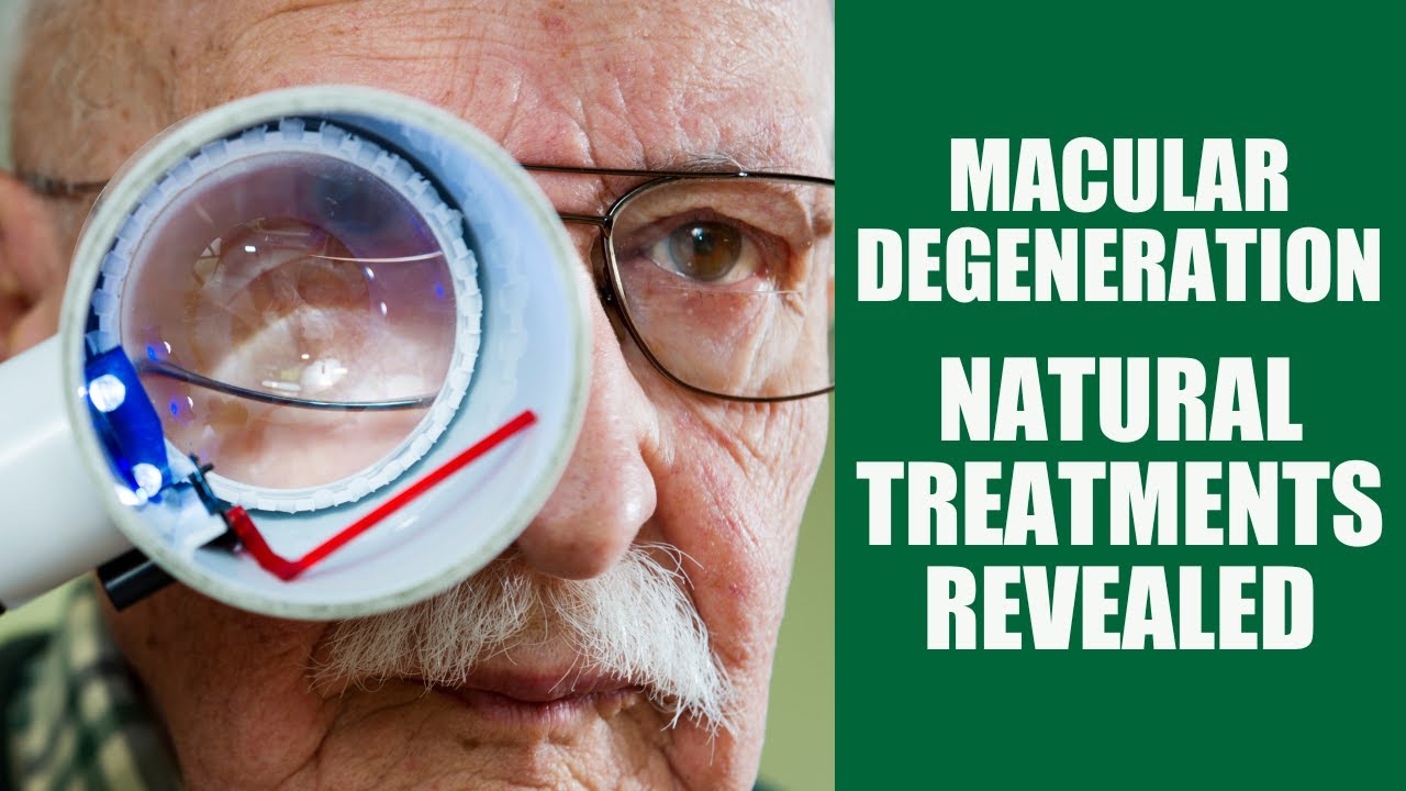 Macular Degeneration Wet Vs Dry Symptoms Causes And Natural Macular Degeneration Wet Vs Dry Symptoms Causes And Natural