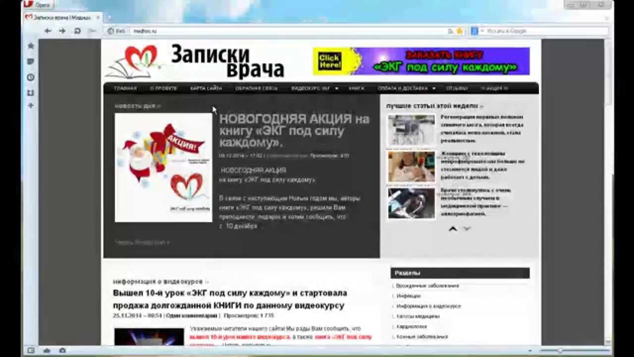 Как заказать книгу "ЭКГ под силу каждому" - YouTube