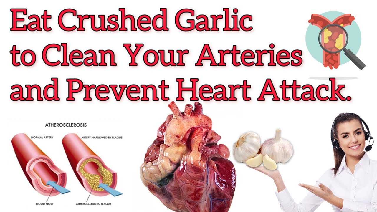 Eat Crushed Garlic to Clean Your Arteries and Prevent Heart Attack ...