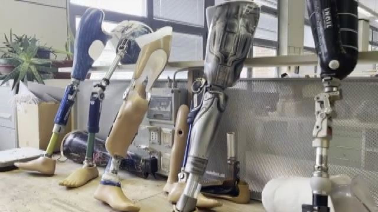 Al Centro Protesi Inail di Budrio: "Siamo pronti per Mustafa" - YouTube