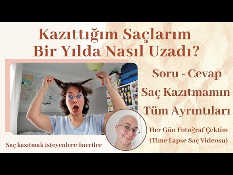 Saçlarımı Kazıtalı Bir Yıl Oldu! Soru - Cevap Ve Öneriler / Time Lapse Saç Uzama Videosu