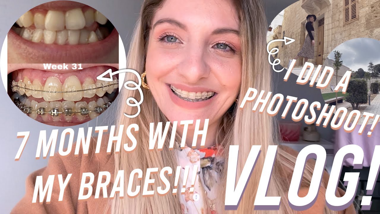 Vlog Seven Months Braces Update Brace Tightening Appointment I