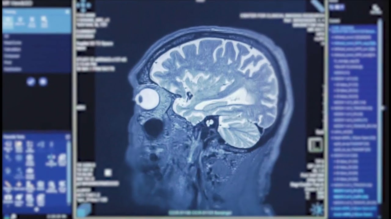 Brain inflammation triggers extreme muscle weakness through pathway ...