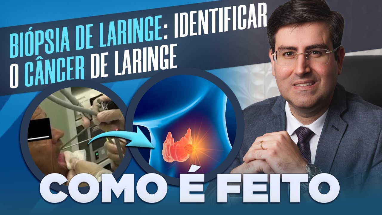 Como é feita a BIÓPSIA DE LARINGE para identificar o CÂNCER DE LARINGE ...