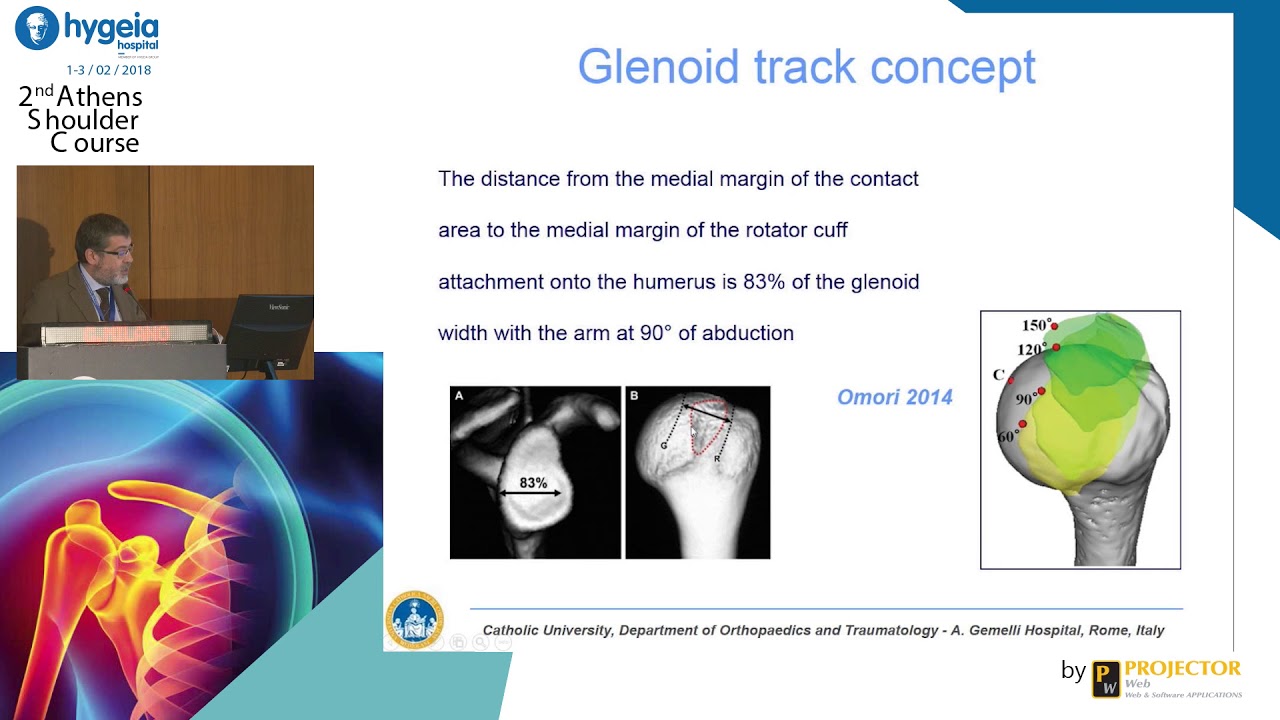 From Engaging Lesions to On Track - Off Track Lesions - G. Milano ...