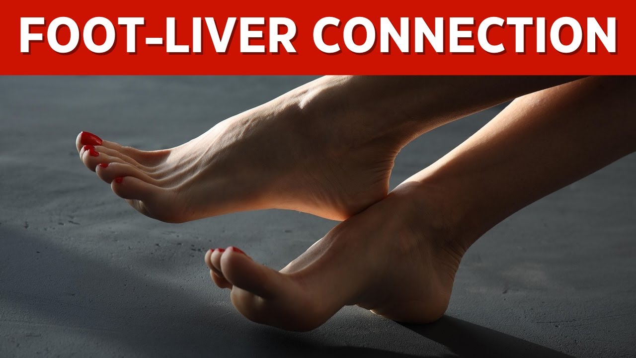How Your Feet Are Warning You About Liver Problems - YouTube