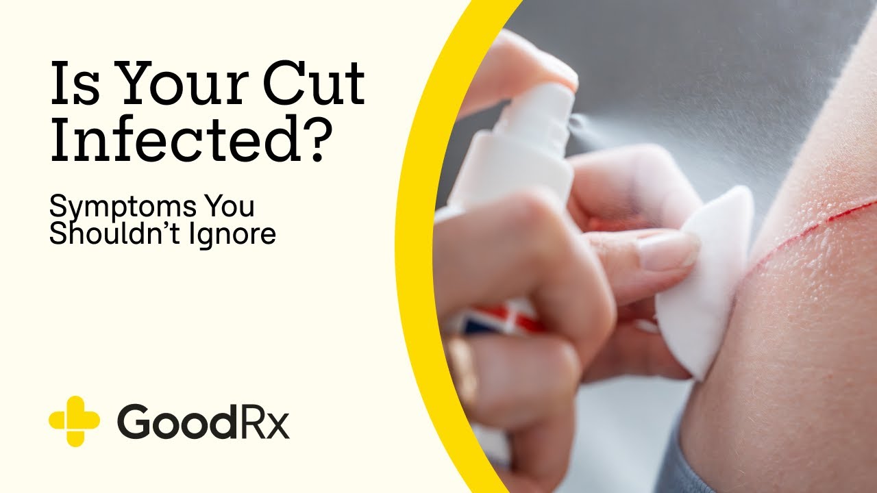 Is Your Cut Infected? Symptoms You Shouldn’t Ignore | GoodRx - YouTube