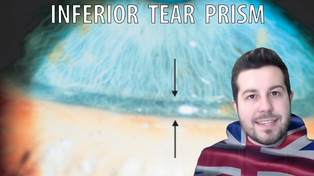 Tear Prism Height - Tear Film Evaluation #1 [ENG] - YouTube
