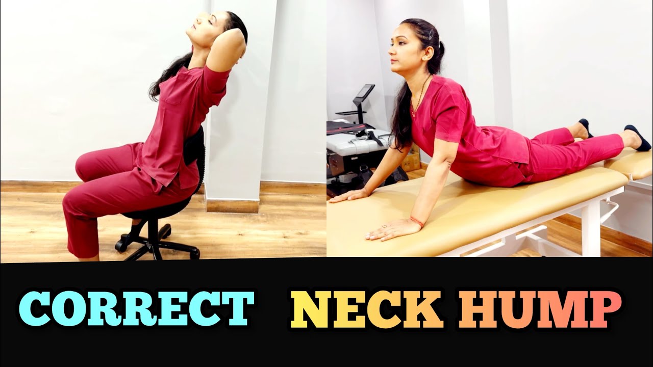 Neck hump exercises in hindi |CORRECT NECK HUMP AT HOME |Dowager’s hump ...