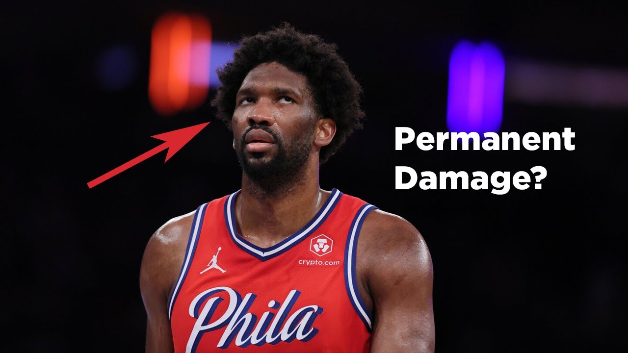 Doctor Reacts to Joel Embiid's Bell's Palsy Diagnosis - YouTube