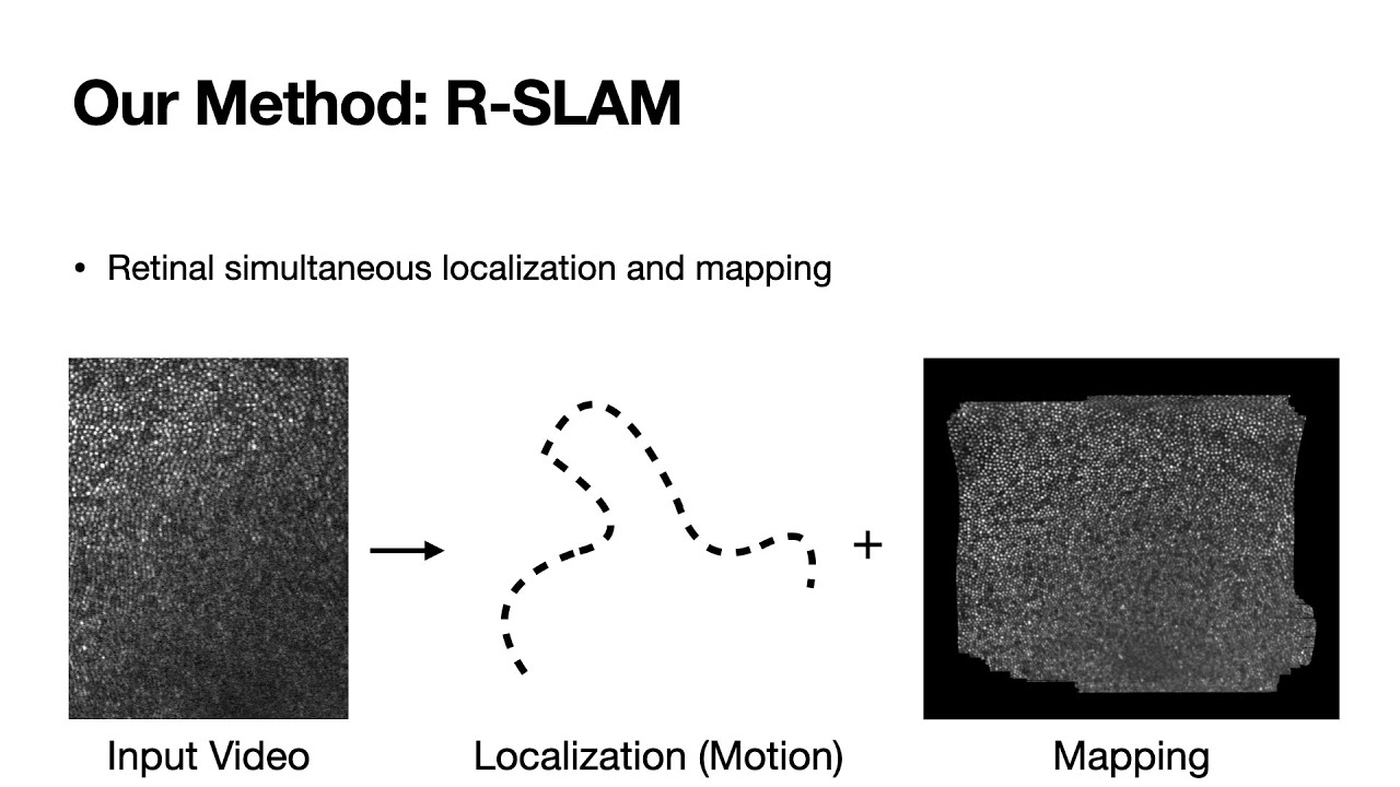 R-SLAM: Optimizing Eye Tracking From Rolling Shutter Video of the ...