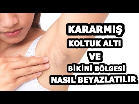 KARARAN  KOLTUK ALTI  VE DİRSEKLER NASIL BEYAZLAŞTIRILIR?