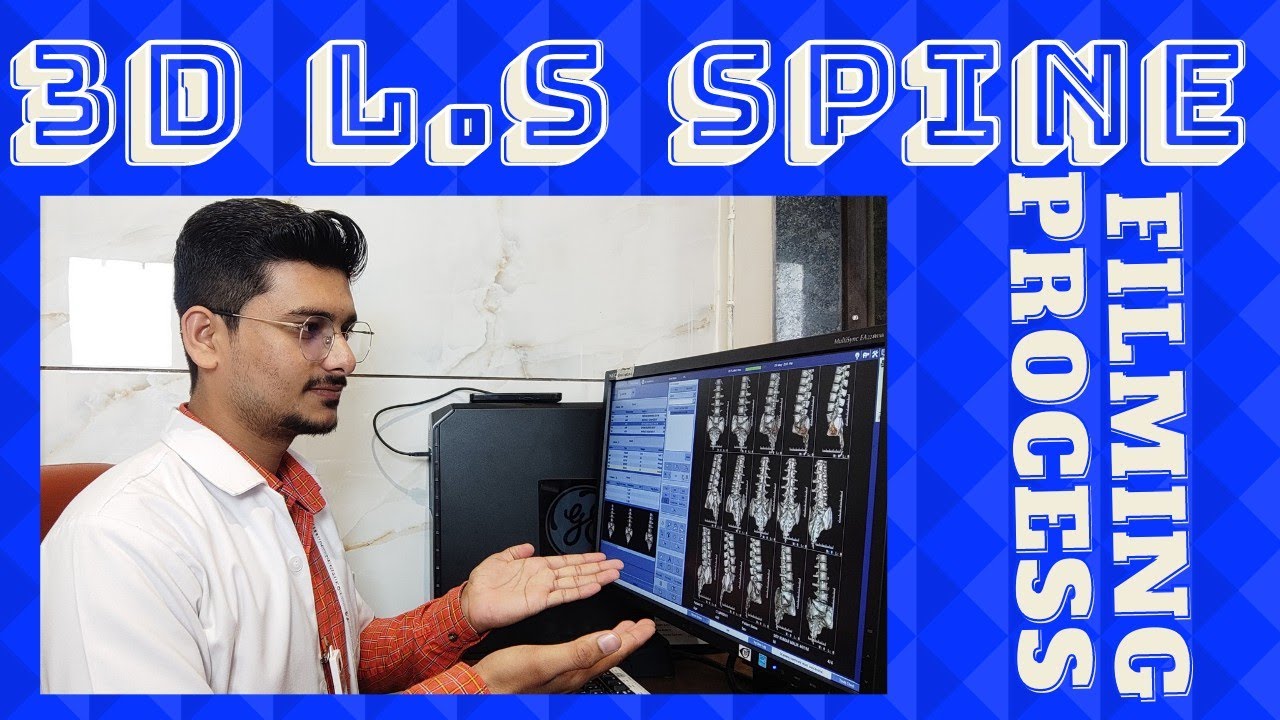 3D L.S Spine filming process| LumboSacral Spine filming technique # ...