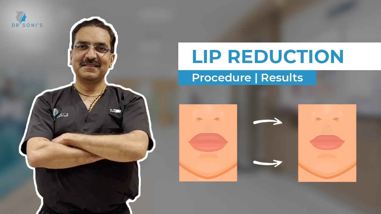 Lower LIP REDUCTION Surgery in India ( Reduce Lip Size ) |Plastic ...